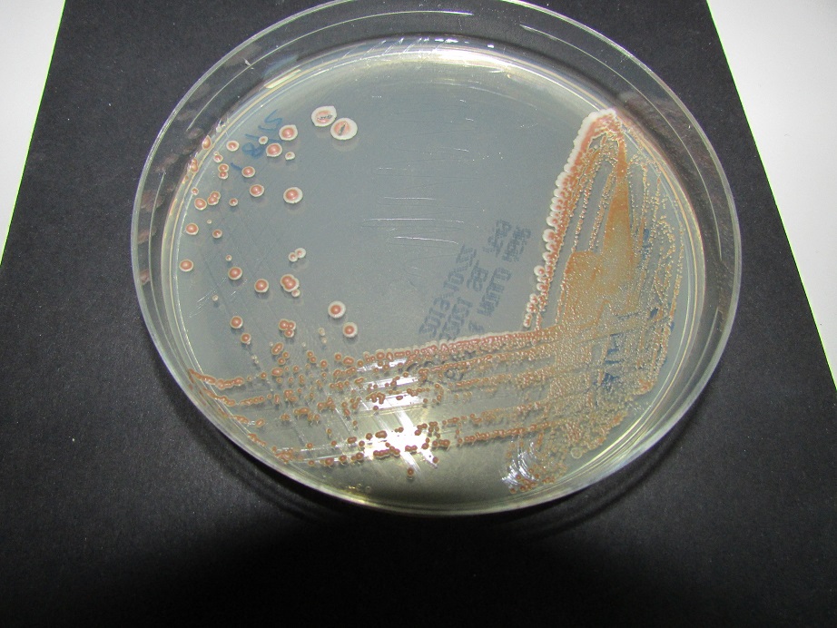 NCYC 2173 - Schizosaccharomyces pombe | National Collection of Yeast ...